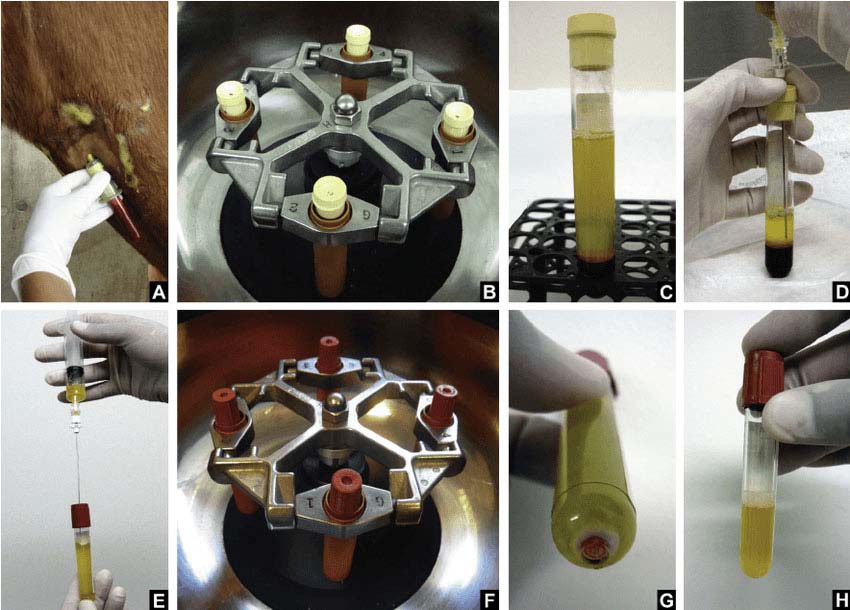 PRP Preparation | Plasma Therapy | PRP Injection MD